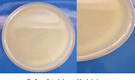 Figure 1 From Isolation And Characterization Of Lytic Bacteriophages