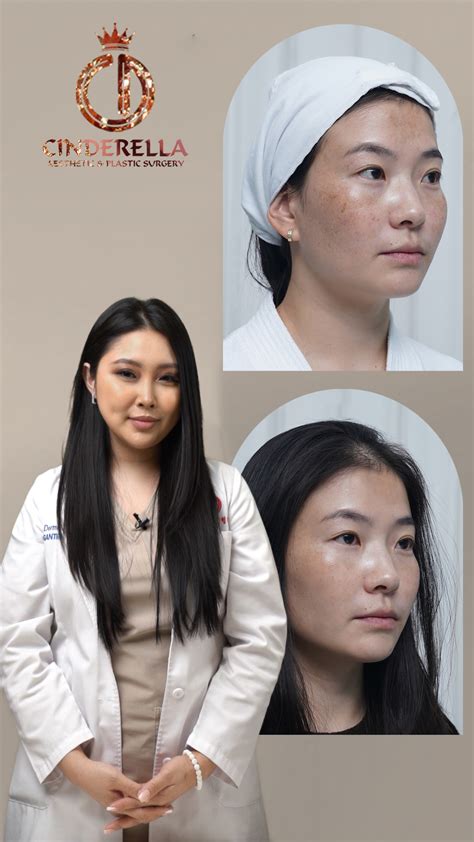 Хүн бүрийн арьсны онцлог сэвхний төрлүүд өөр тул гарах эмчилгээний үр