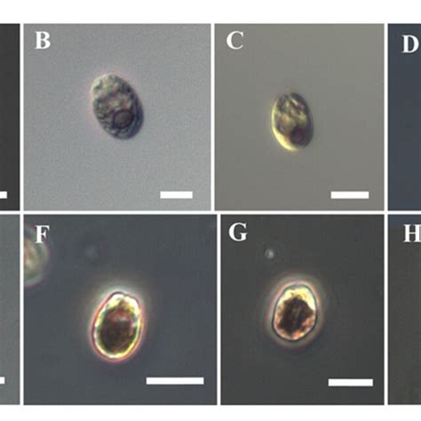 Phase Contrast A D E H And Differential Interference Contrast B C Download Scientific