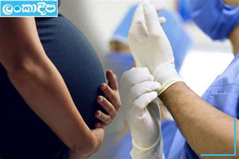 ද සොයිසා රෝහලේ දුර්ලභ දරු ප්‍රසූතියක් Lankadeepa Online