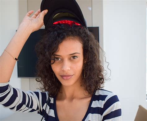 How Vincis Laser Technology Eliminates Patchy Micro Scalp Pigmentation