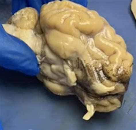Sheep Brain Lateral View Diagram Quizlet