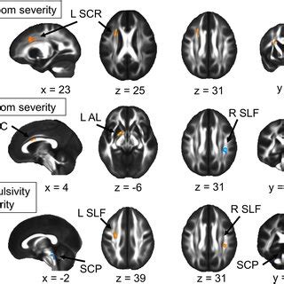 Sex Differences In Dimensional Associations Between Download Scientific Diagram