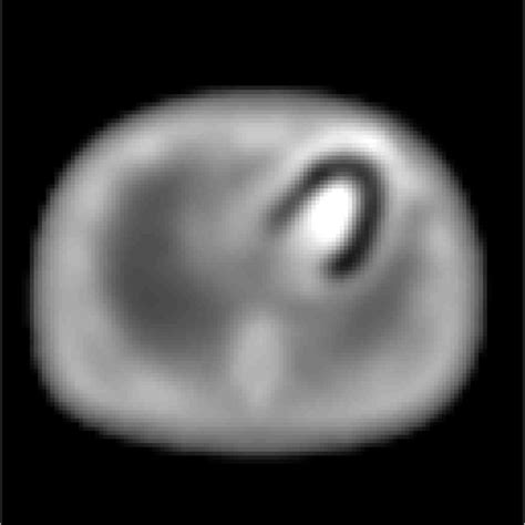 A Attenuation Map Phantom B Activity Phantom C Em Ac