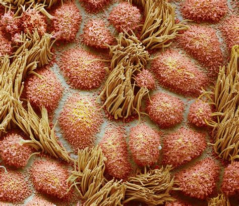Fallopian Tube SEM Stock Image C Science Photo Library
