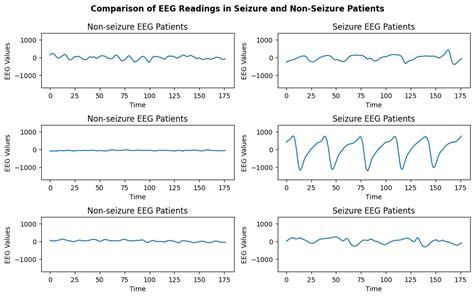 Ds3 Epileptic Seizure Prediction