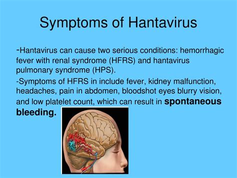 Ppt Hantavirus Powerpoint Presentation Free Download Id3553979