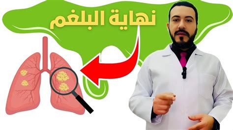تخلص من البلغم نهائياً بأقوى مذيب بلغم طبيعي Youtube