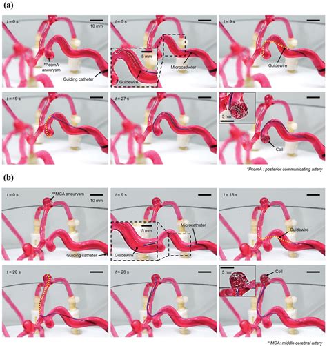 Simulation Of Endovascular Intervention Under Optical Images In A