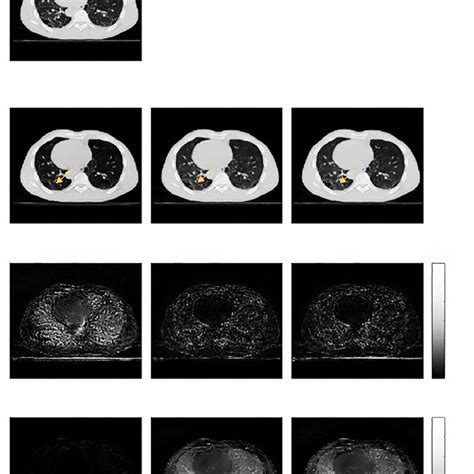 Overall Transfer Learning Workflow Download Scientific Diagram