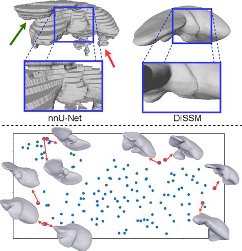 figure 1 from deep implicit statistical shape models for 3d medical