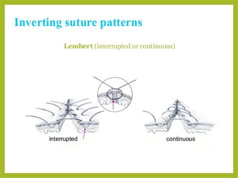 Basic Suture Patterns
