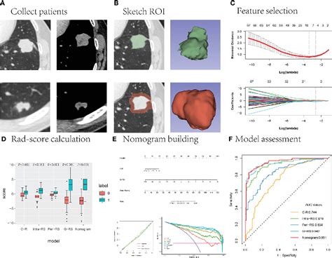 Figure 1 From Identification Of Pulmonary Adenocarcinoma And Benign Lesions In Isolated Solid