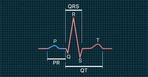 What P Waves Look Like On Your Watch Ecg Qaly