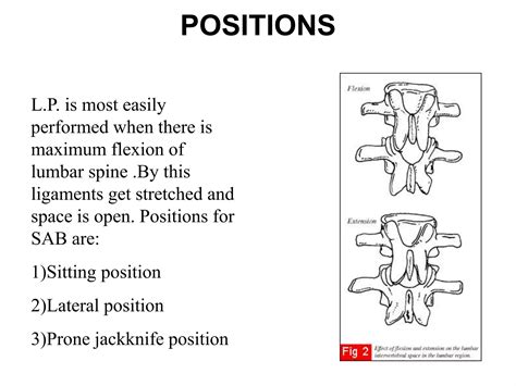 Spinal And Epidural Anaesthesia Pptx
