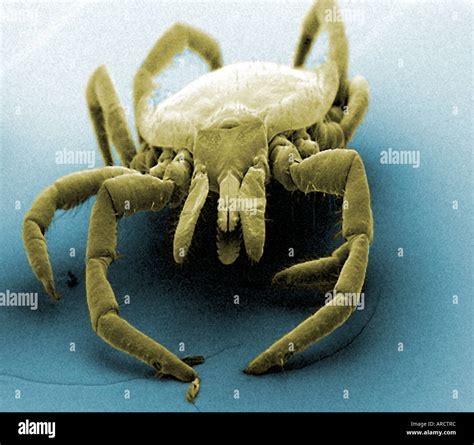 A Scanning Electron Micrograph Sem Of The Deer Tick Ixodes Dammini
