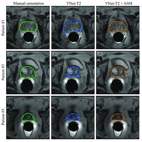 Comparison Between Manual Annotations First Column And The