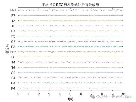 【脑电信号】基于形态学滤波的脑电信号eeg处理附matlab代码 eeg 代码 csdn博客