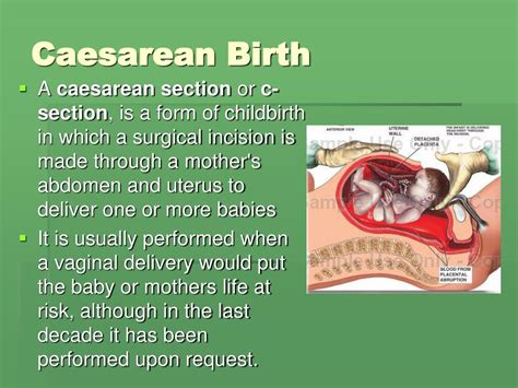 Ppt Pregnancy Powerpoint Presentation Free Download Id1797100