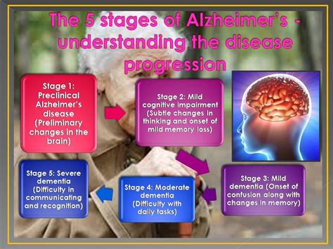 Alzheimer S Stages