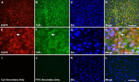 Epidermal Growth Factor Receptors Egfrs And Transforming Growth Download Scientific Diagram