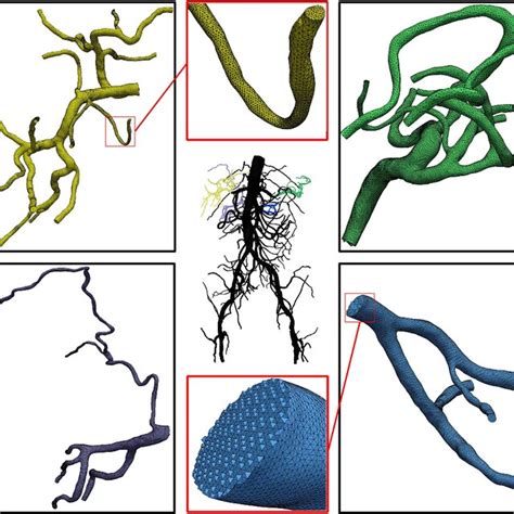 A Schematic Diagram Of A Coarse Mesh For The Abdominal Aorta Meshes