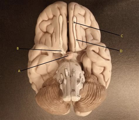 Brain Diagram Quizlet