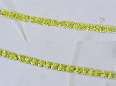 Filamentous Green Algae Microscopy Of Nature