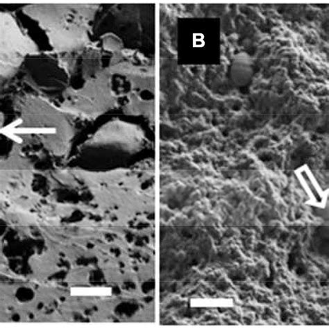 Scanning Electron Microscopy Left Image Of Low Fat Cheddar Cheese