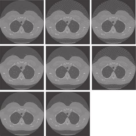 Pdf Applications Of Nonlocal Means Algorithm In Low Dose X Ray Ct Image Processing And