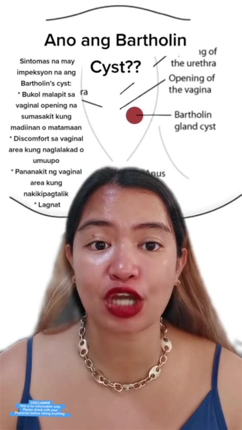 Ano Nga Ba Ang Bartolin Cyst Alamin Sa Videong Ito This Might Help You