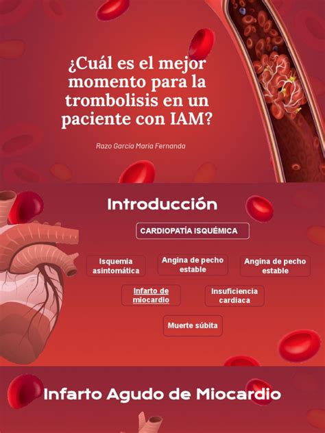 Momento óptimo Para Trombolisis En Iam Pdf Infarto De Miocardio