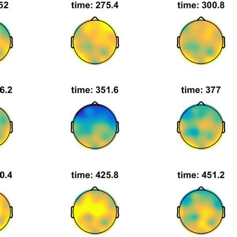 Topographic Scalp Maps Of The Difference Wave Between The Principle C