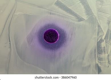 Disk Diffusion Test Stock Photo Shutterstock