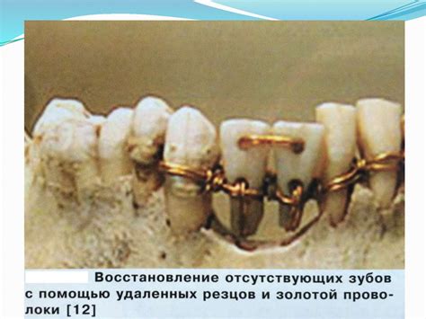 Предмет, цели и задачи ортопедической стоматологии - презентация онлайн