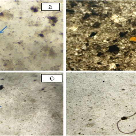 Binocular Microscopic Images At 20 × Of Different Types Of Mps In