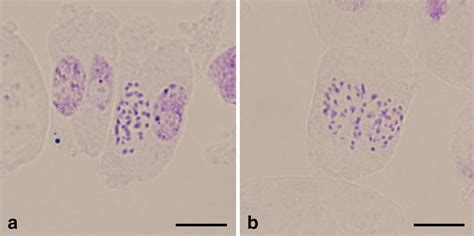 Somatic Chromosome Of Diploid And Tetraploid P Pseudo Simonii × P Download Scientific Diagram