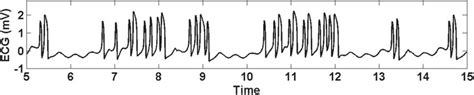 Numerical Simulation Of A Chaotic Ecg Download Scientific Diagram