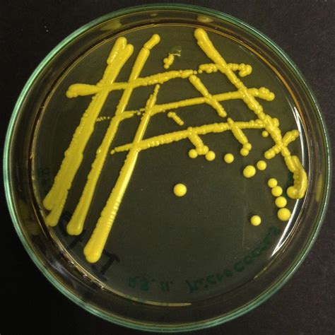 Micrococcus Letus Is Astonishing Microorganism Where It Has More Secrets Than It May Appear At