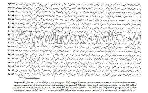 Full Form Eeg Electroencephalogram Eeg Nhs