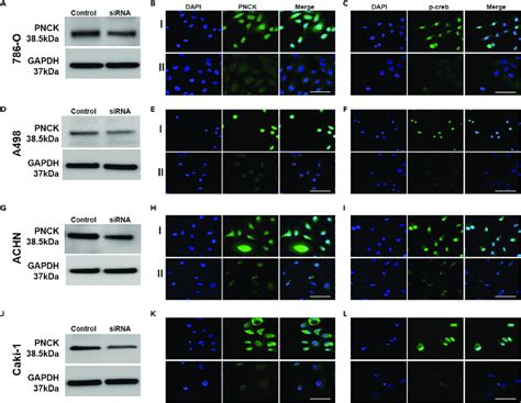 Characterization Of Pnck K D Rcc Cell Lines A C 786 O D F A498 G I