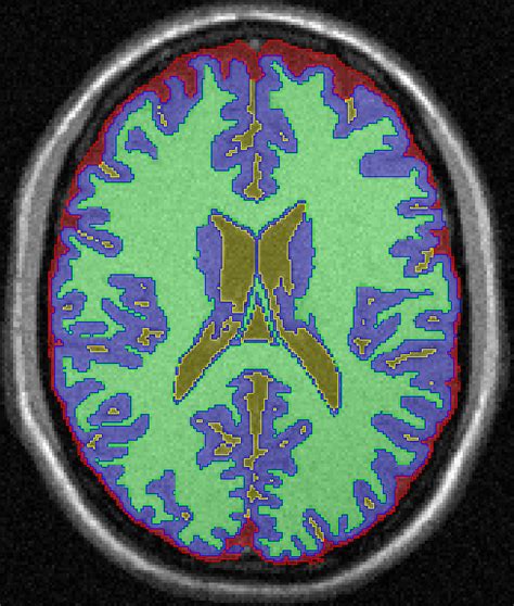 Slices Of A Fmri In A Instant Of Time Download Scientific Diagram