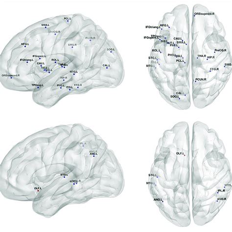 Pdf Disrupted Brain Structural Connectivity Network In Subcortical Ischemic Vascular Cognitive