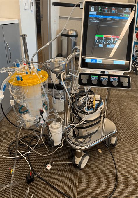 Spectrum Medical Nrp Perfusion Solution