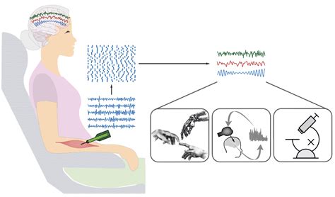 20220302 15 H Towards Minimally Invasive Interfaces With The Central Nervous System Jaime