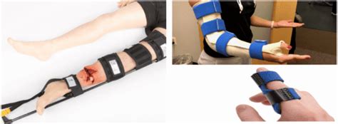 Orthopedic Nursing Care Nurses Revision