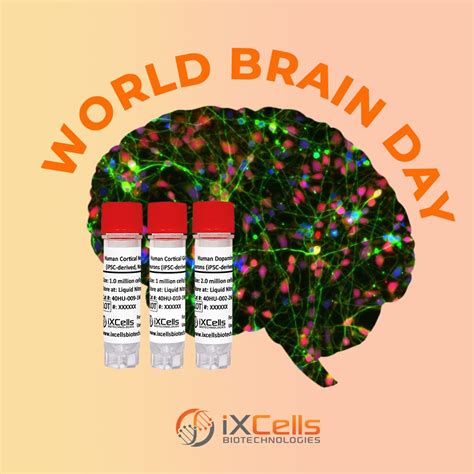Ixcells Biotechnologies On Linkedin Search Result Cell Model Expert Ipsc Primary Cells