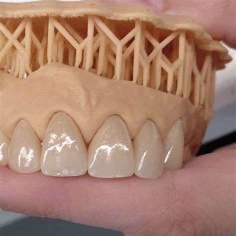 Establishment Of Mutually Protected Occlusion After Mandibular