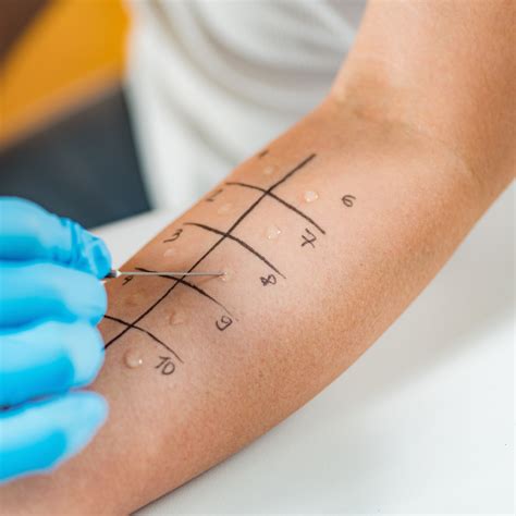 Eczema Triggers And Grading — The Pediatrician Mom