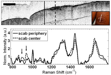 Figure 1 From Combined Raman Spectroscopy And Optical Coherence Tomography Device For Tissue